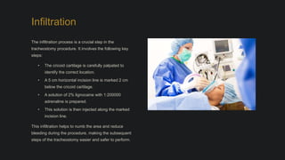 Tracheostomy-A-LIFESAVING Surgical-Airway .pptx