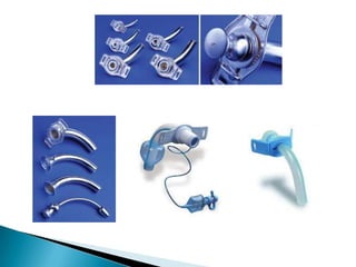 Tracheostomy a life saving emergency procedure | PPTX