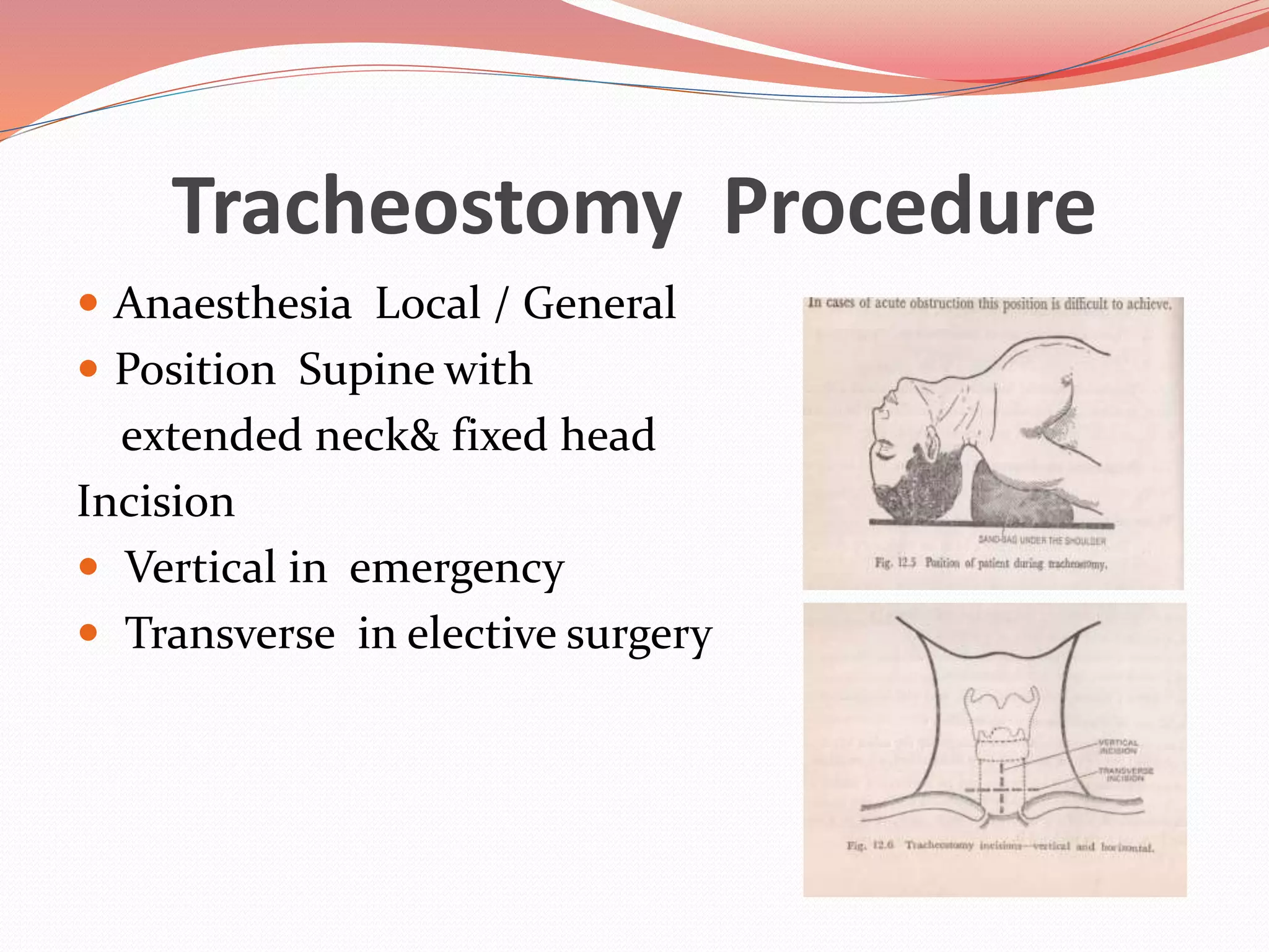 Tracheostomy ashly | PPTX | Ear, Nose and Throat Conditions | Diseases ...