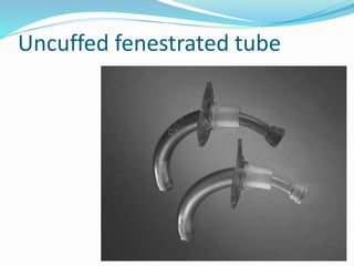 Tracheostomy decanulation | PPTX
