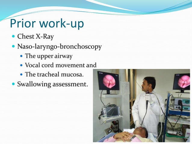 Tracheostomy decanulation | PPTX