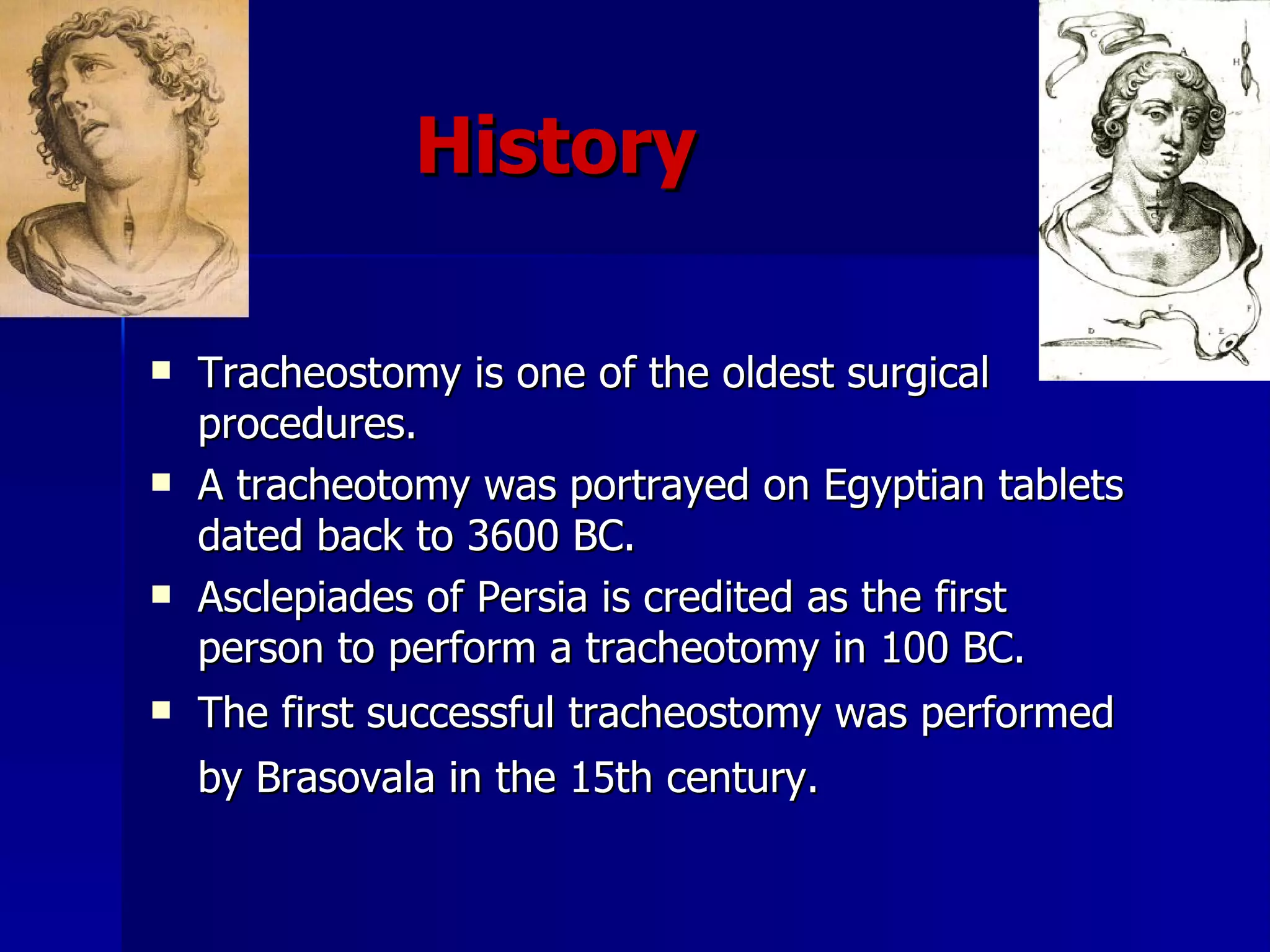 Tracheostomy | PPT