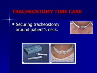 Tracheostomy | PPT