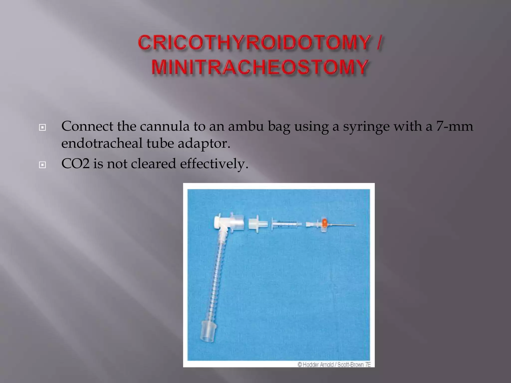 Tracheostomy -INDICATIONS,CONTRAINDICATIONS,PROCEDURE,COMPLICATIONS | PPTX