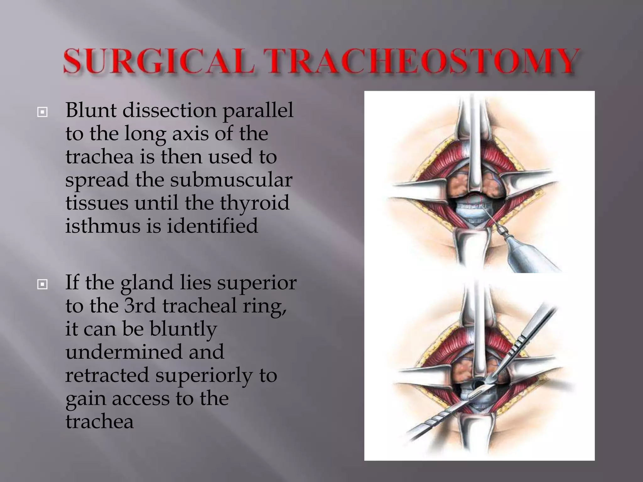 Tracheostomy -INDICATIONS,CONTRAINDICATIONS,PROCEDURE,COMPLICATIONS | PPTX