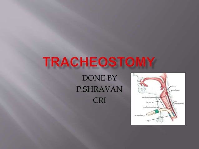 Tracheostomy -INDICATIONS,CONTRAINDICATIONS,PROCEDURE,COMPLICATIONS ...