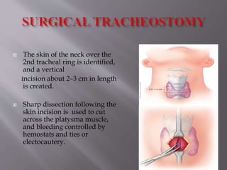 Tracheostomy -INDICATIONS,CONTRAINDICATIONS,PROCEDURE,COMPLICATIONS | PPTX