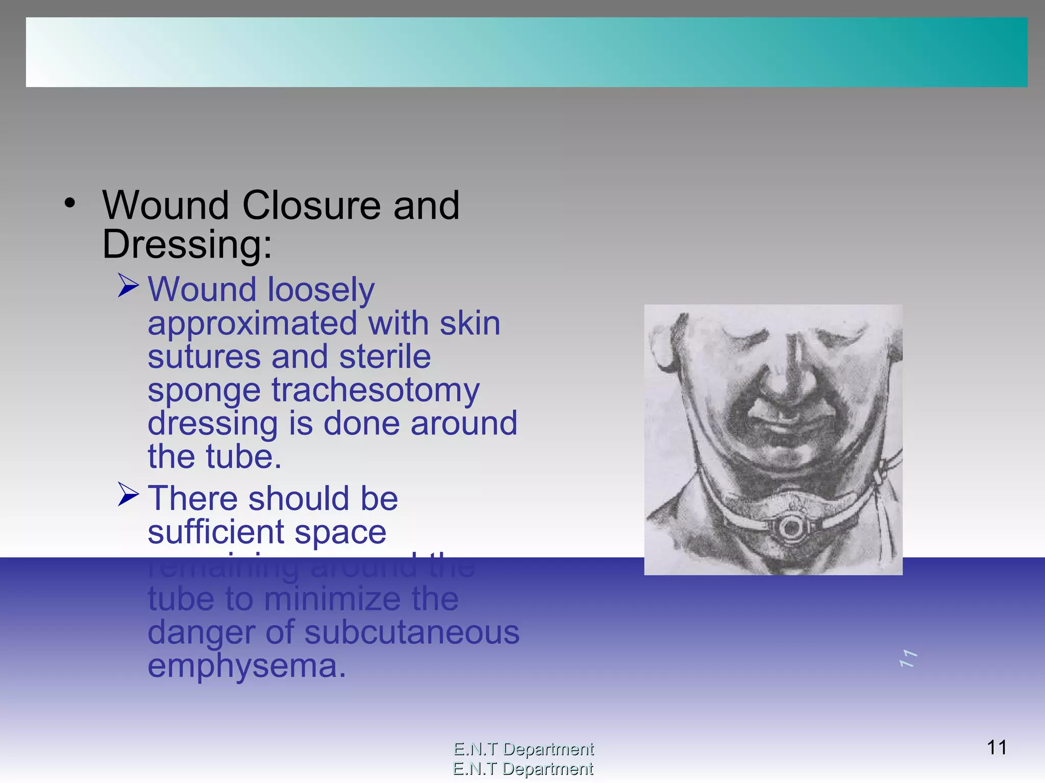 Tracheostomy surgical procedure | PPT