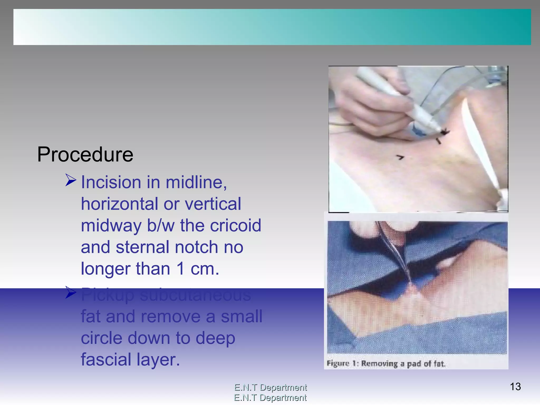 Tracheostomy surgical procedure | PPT