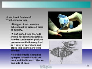Tracheostomy surgical procedure | PPT
