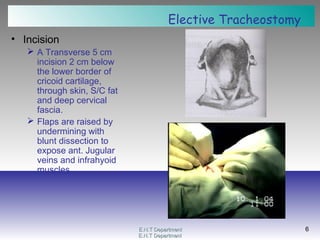 Tracheostomy surgical procedure | PPT
