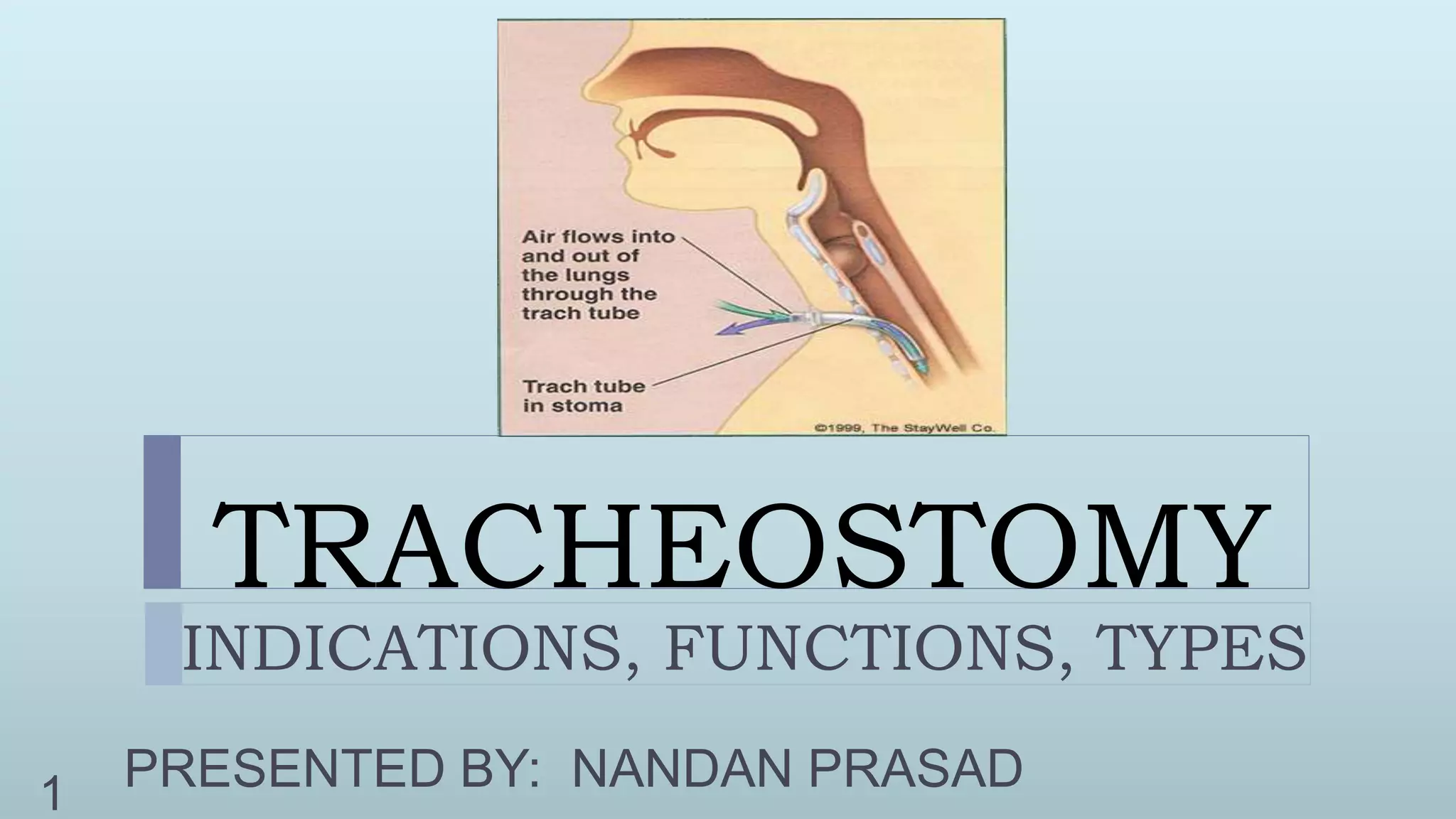 Tracheostomy- indications, types | PPTX