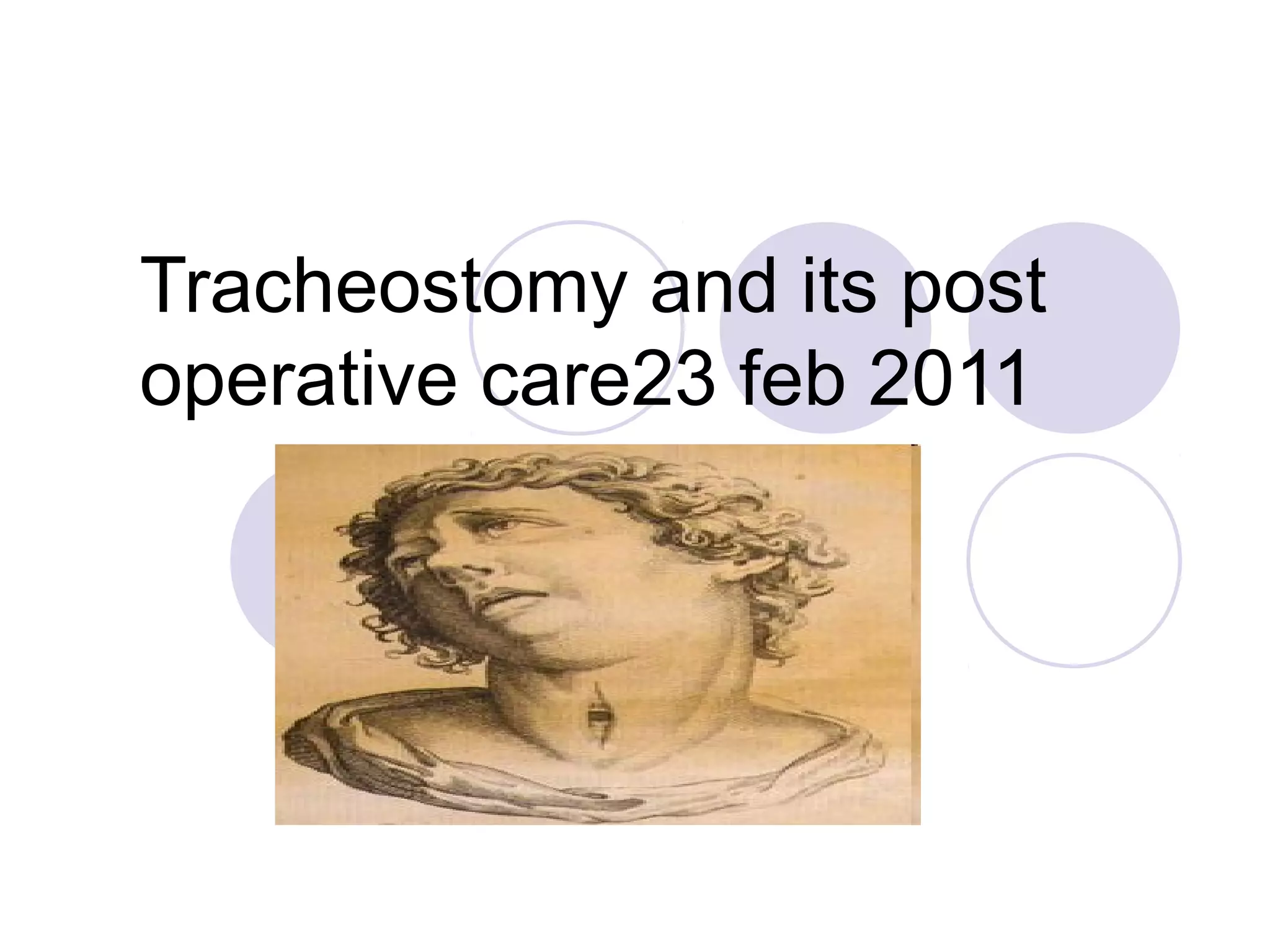 Tracheostomy and its post op care last | PPT