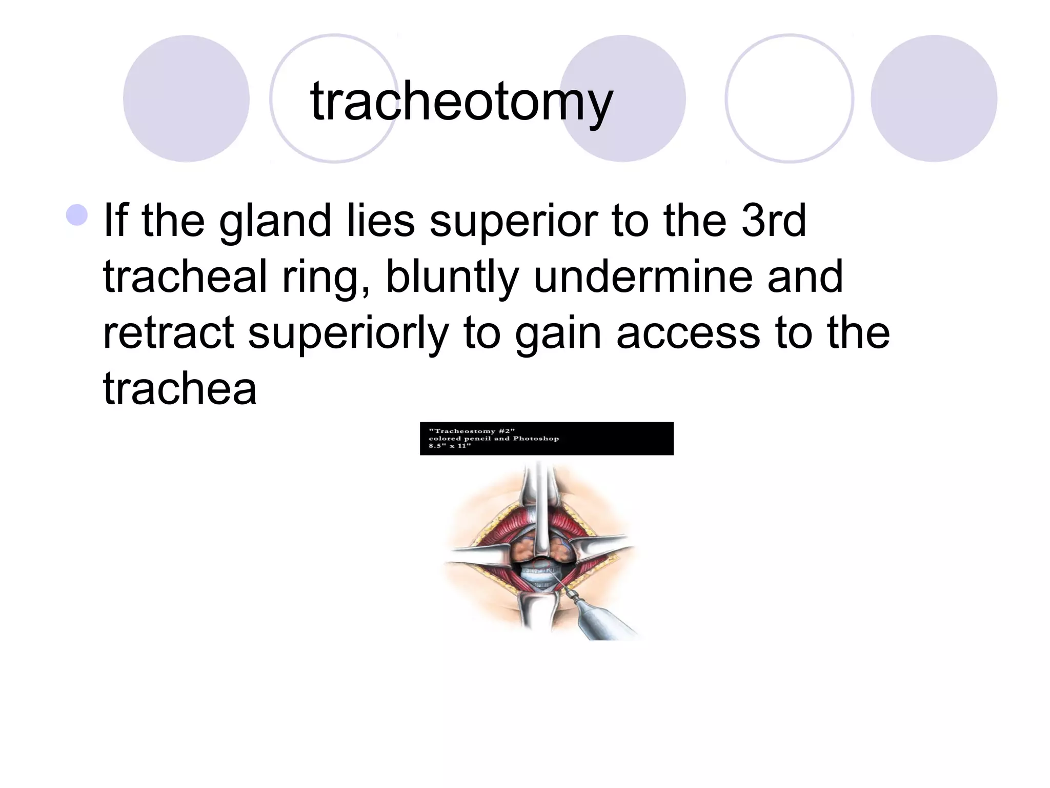 Tracheostomy and its post op care last | PPT