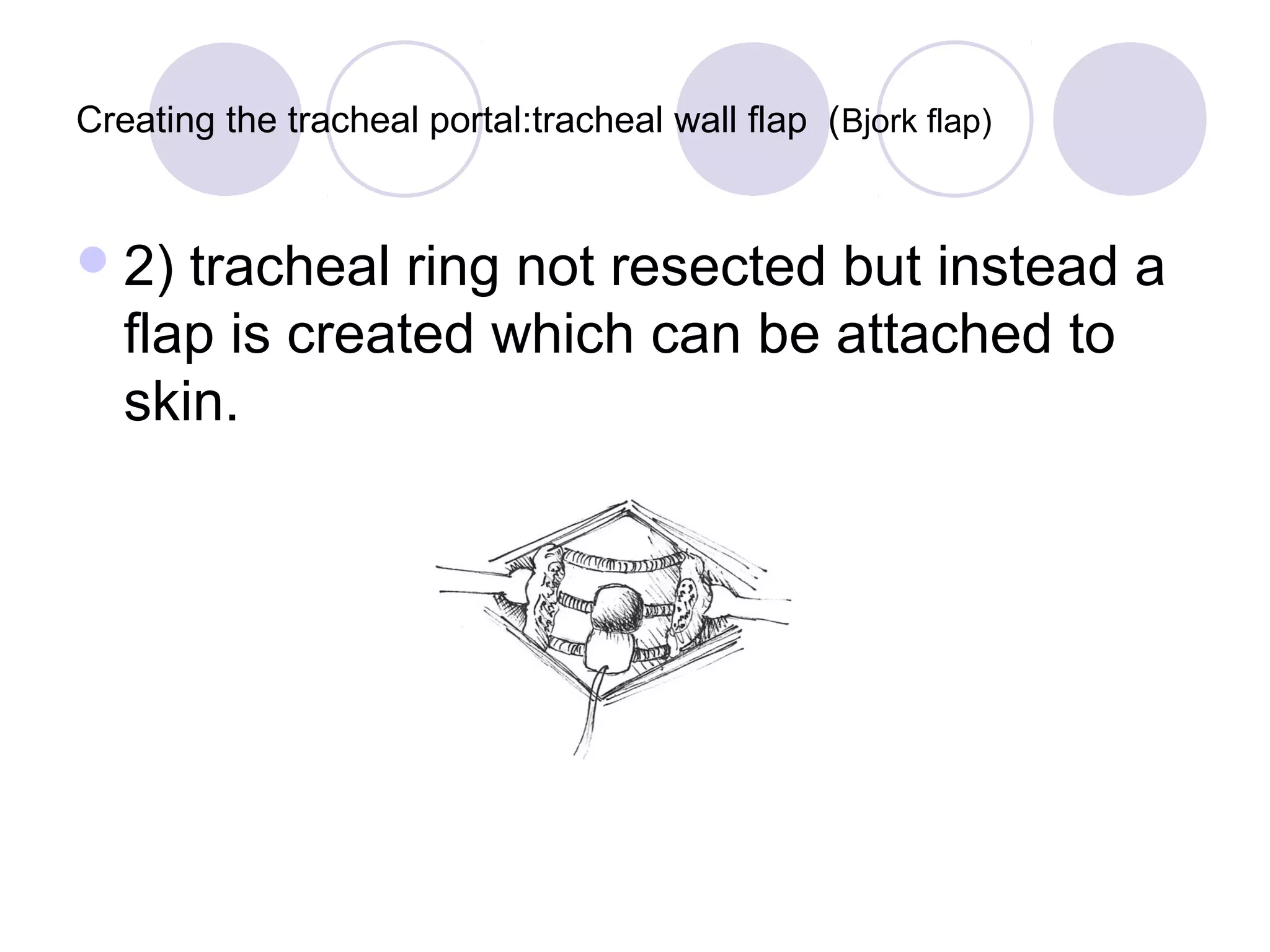 Tracheostomy and its post op care last | PPT