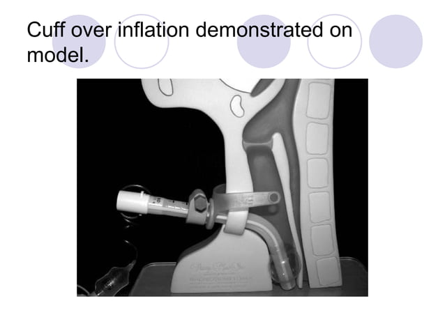 Tracheostomy and its post op care last | PPT | Ear, Nose and Throat ...