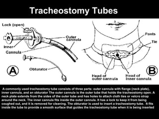 Tracheostomy | PPT