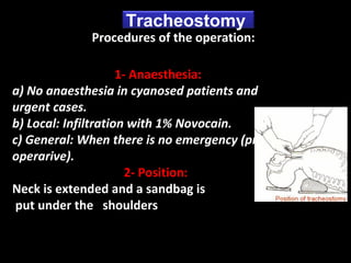 Tracheostomy | PPT