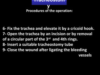Tracheostomy | PPT