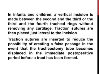 Tracheostomy by Kanato | PPTX
