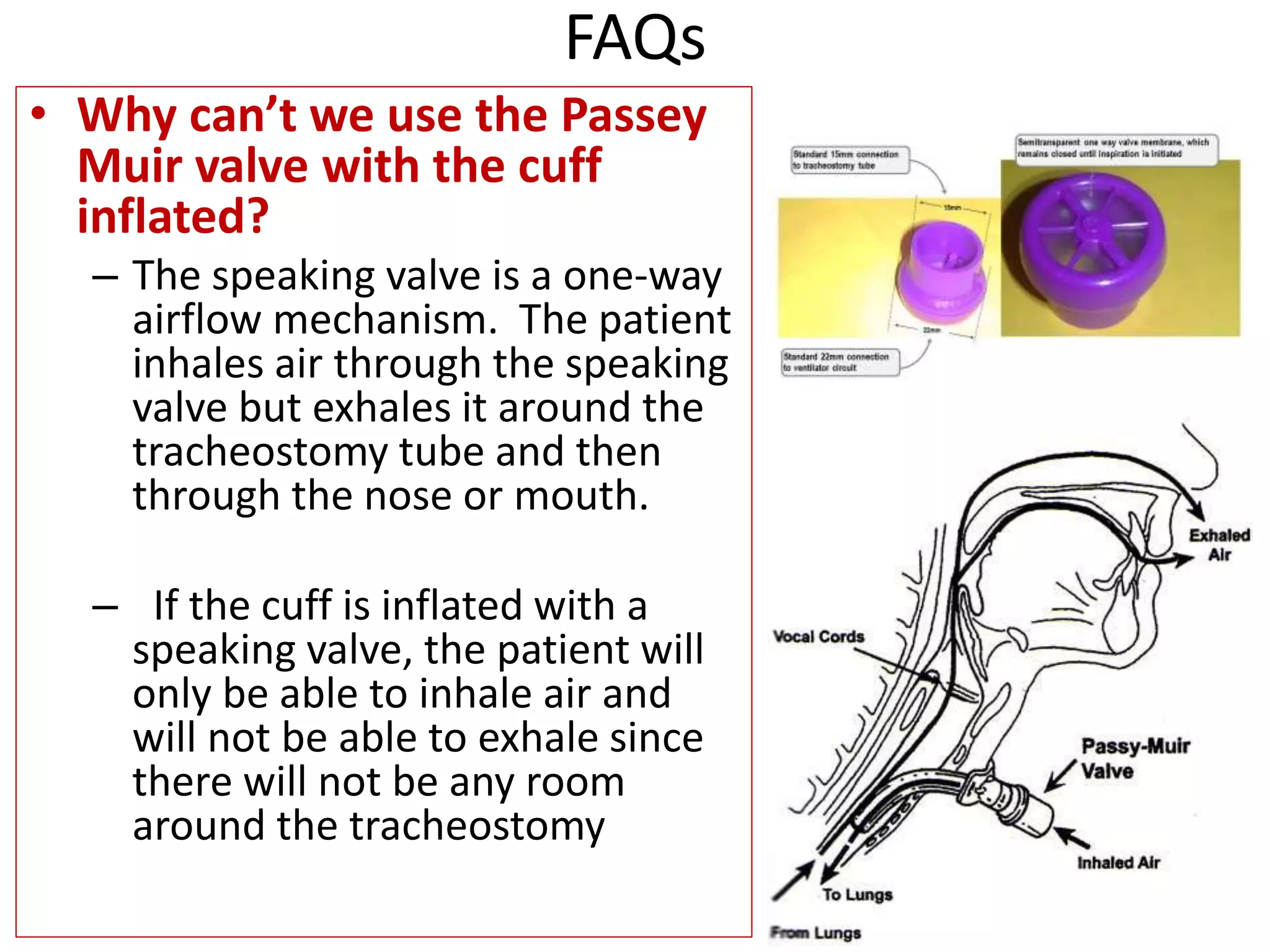 Tracheostomy care | PPT