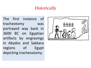 Tracheostomy care | PPTX
