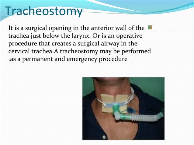 Tracheostomy care | PPT