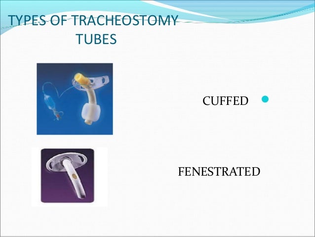 Tracheostomy care