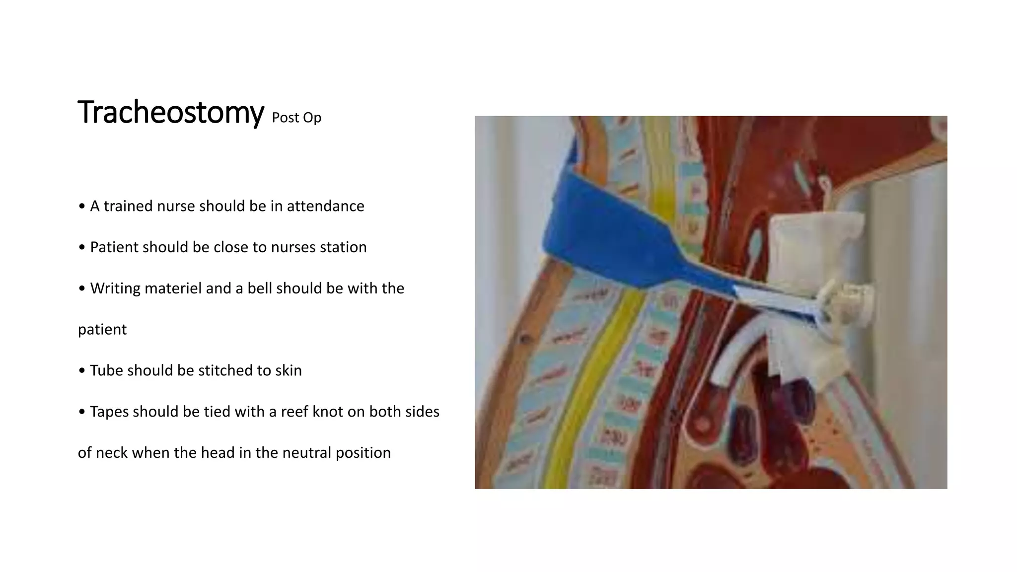 Tracheostomy care | PPTX