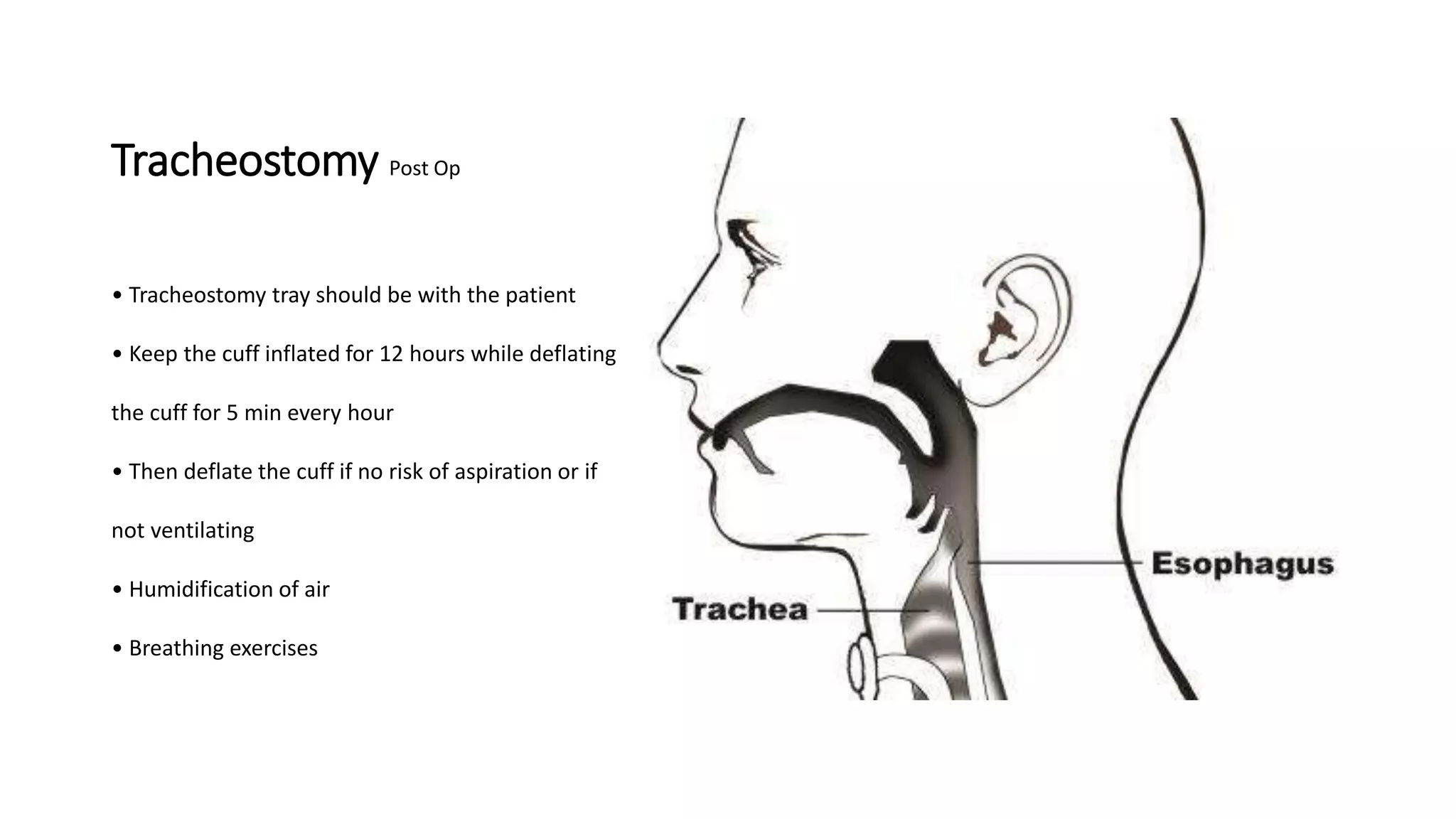 Tracheostomy care | PPTX