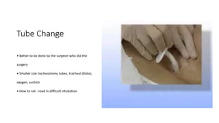Tracheostomy care | PPTX