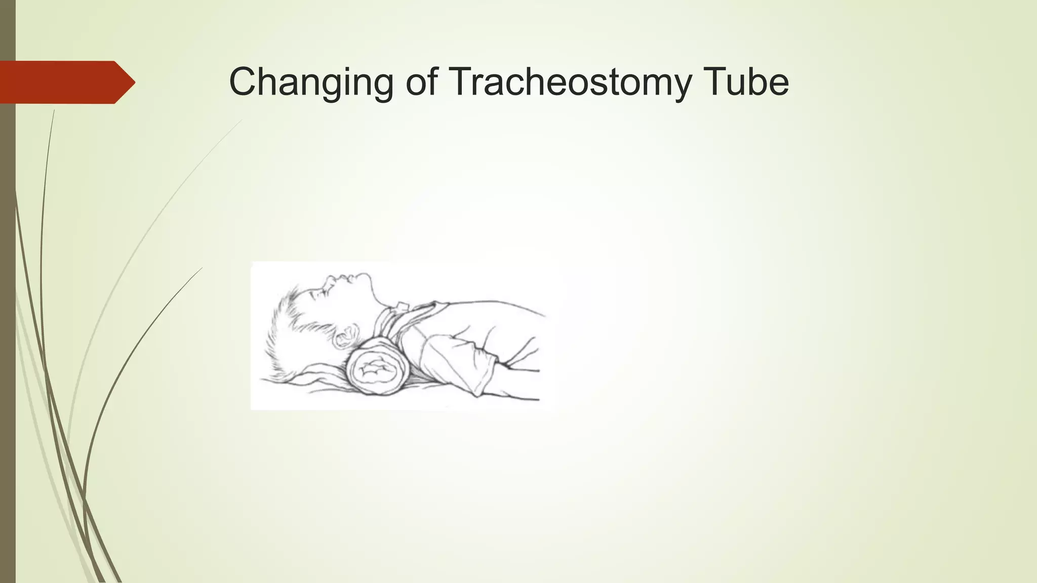 Tracheostomy Care for Nursing Staff | PPTX