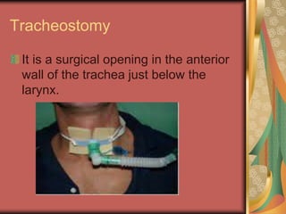 Tracheostomy care | PPT