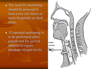 TRACHEOSTOMY care.ppt