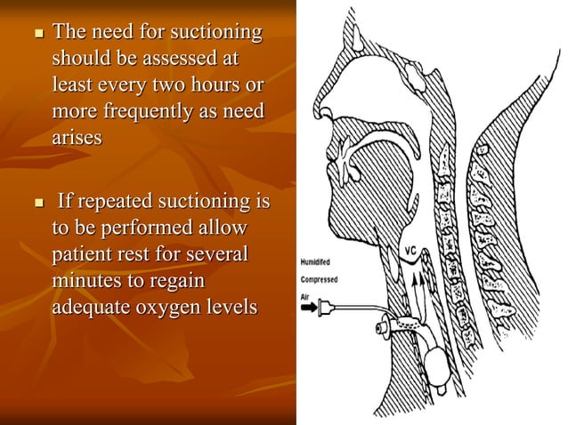 TRACHEOSTOMY care.ppt