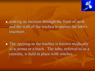 TRACHEOSTOMY care.ppt