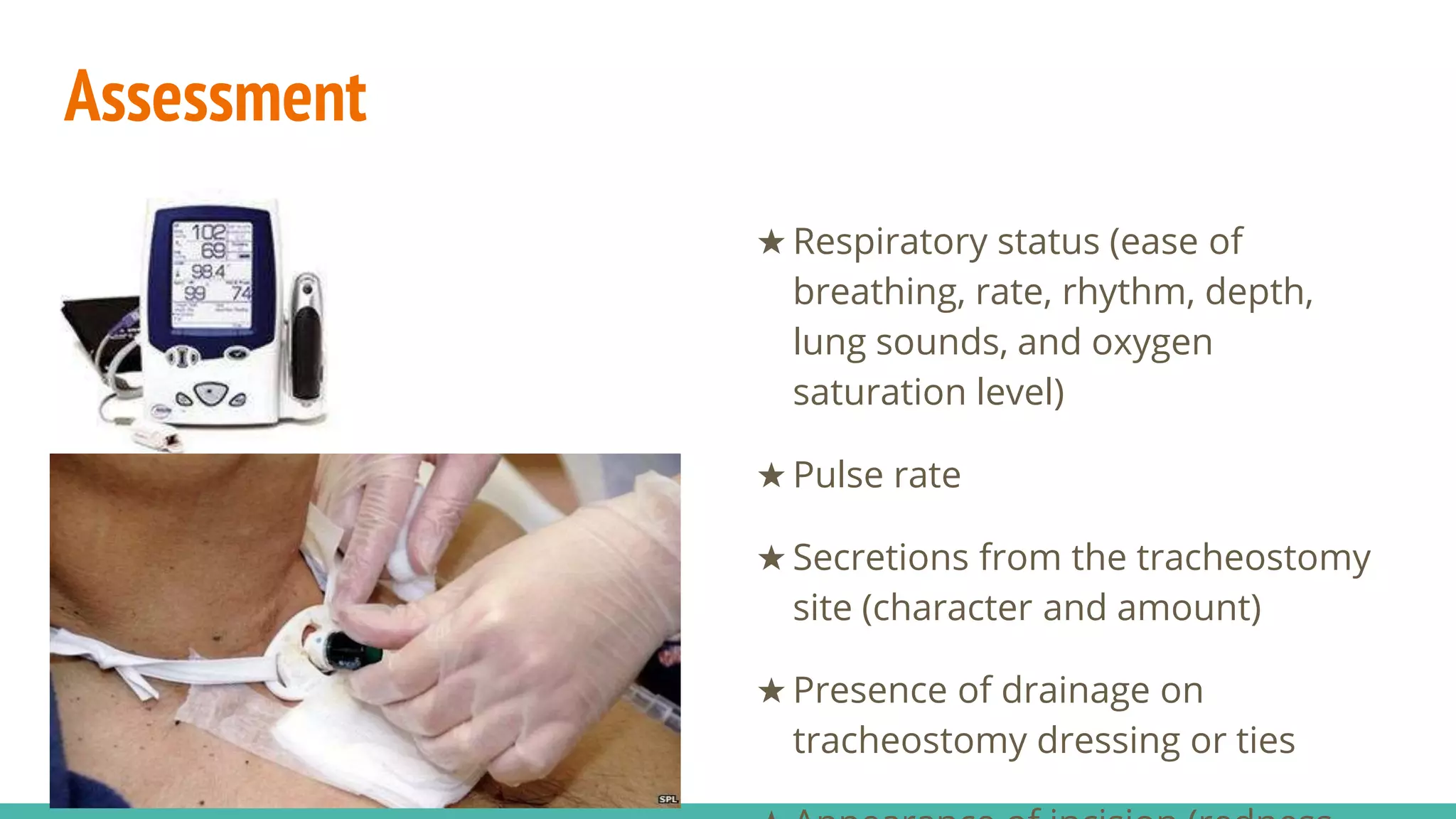 Tracheostomy care and management | PPTX