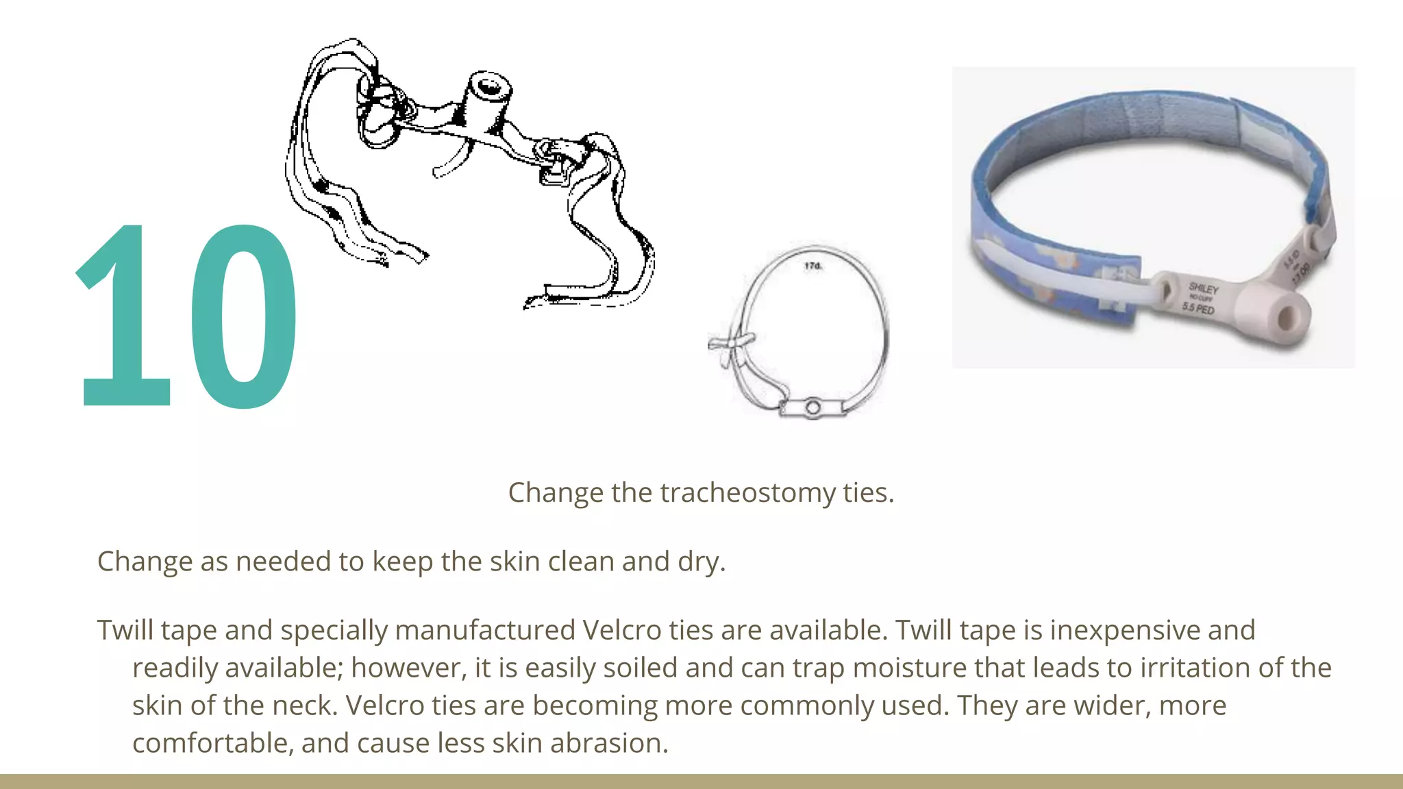 Tracheostomy care and management | PPTX