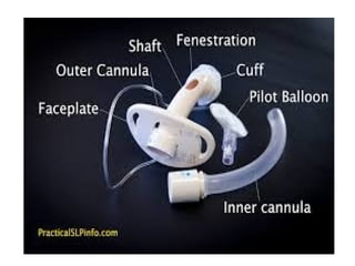 Tracheostomycarebitto 131204115039-phpapp01 | PPT