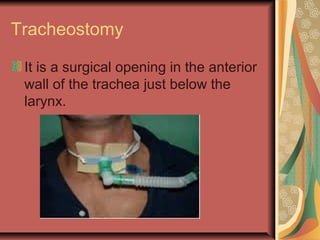 Tracheostomy care bitto | PPT