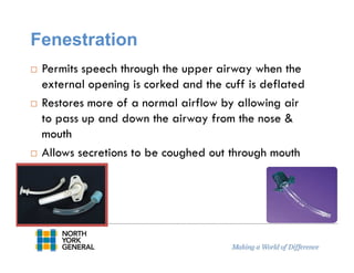 Tracheostomy care & management | PDF
