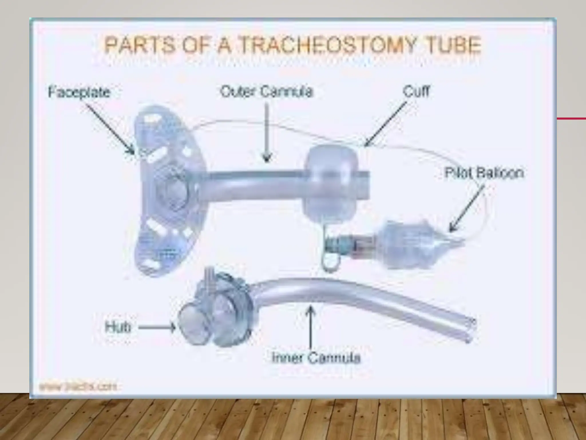Tracheostomy Care New.pptx