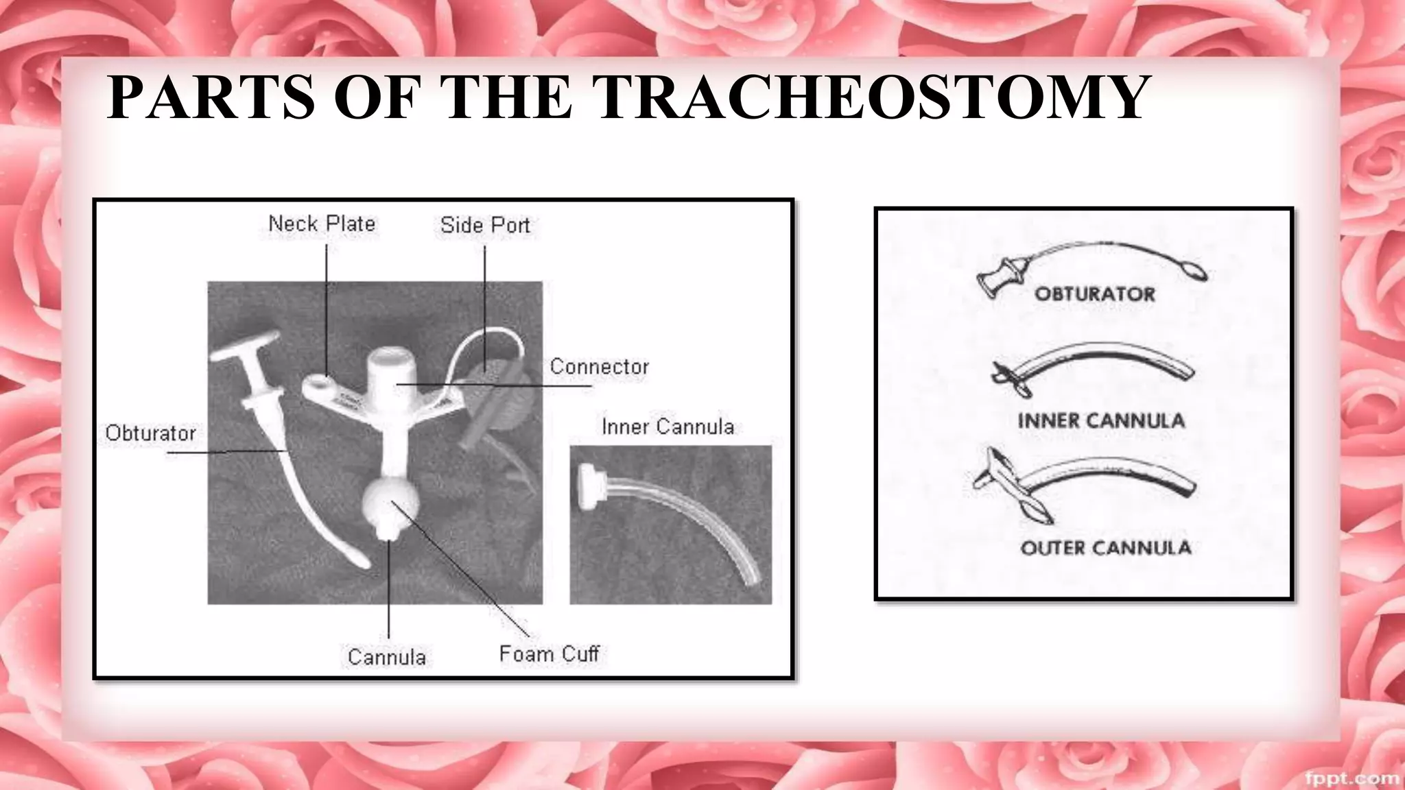 Tracheostomycare ppt | PPTX