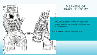 Tracheostomy_Care_Presentation (1).pptxFBRF | PPTX