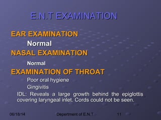 Tracheostomy case report | PPT
