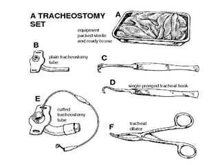 Tracheostomy class | PPTX