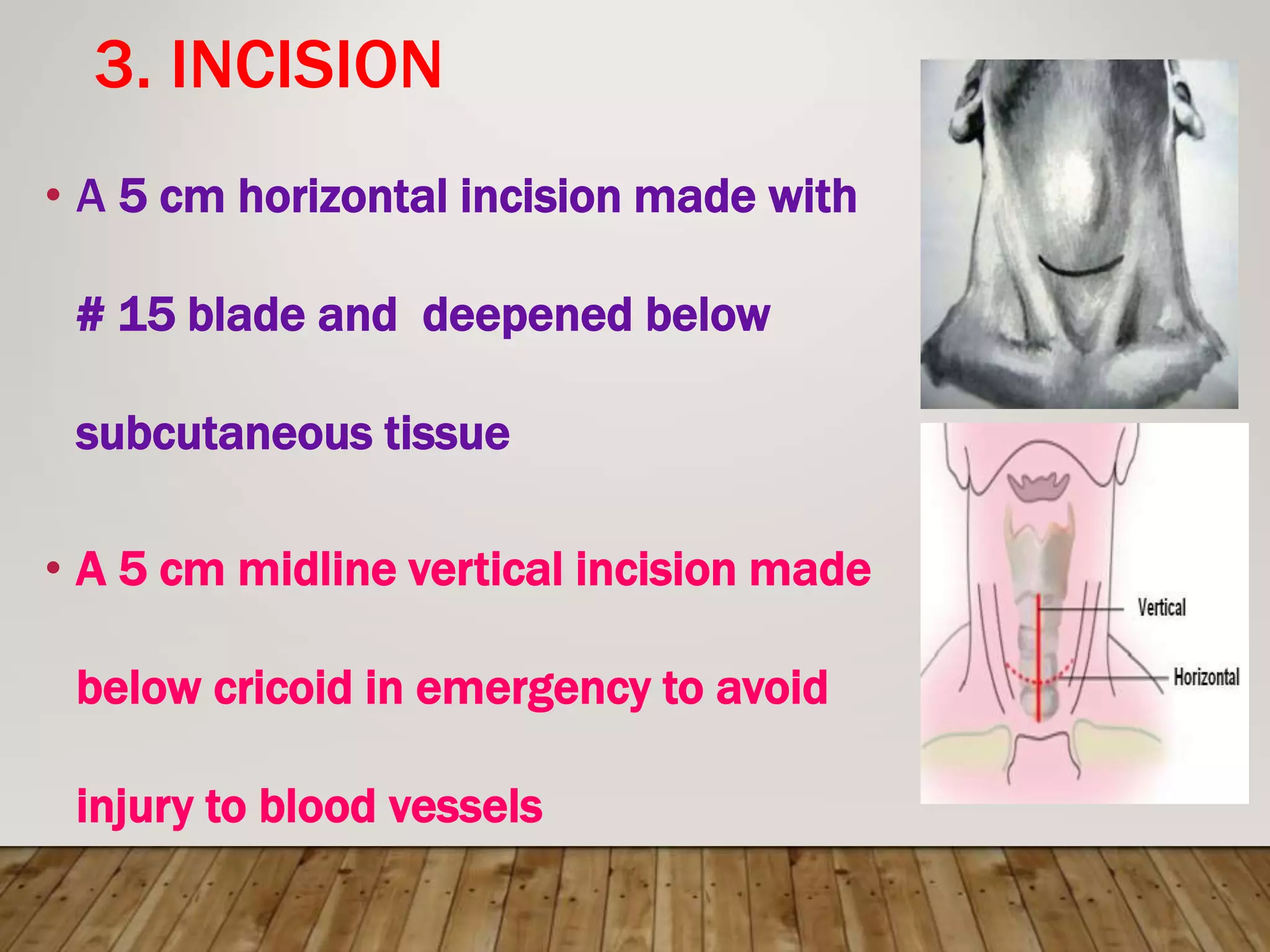 Tracheostomy( dr. krishna prasad koirala) | PPT