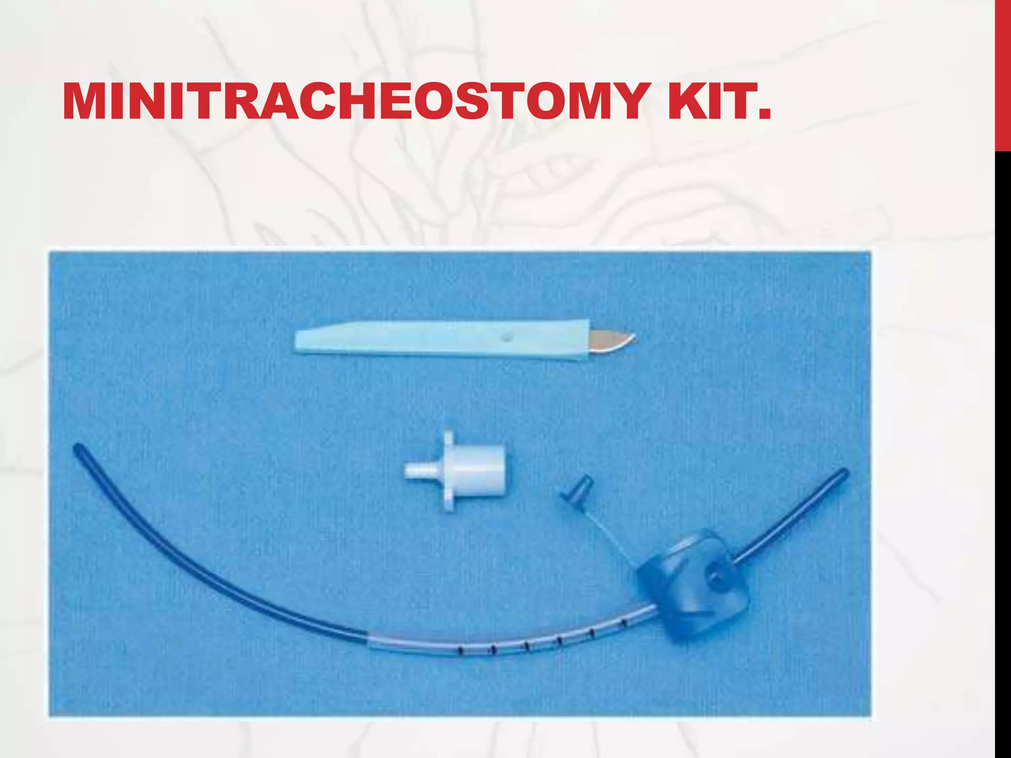 Tracheostomy | PPTX | Thyroid Disorders | Endocrine and Metabolic Diseases