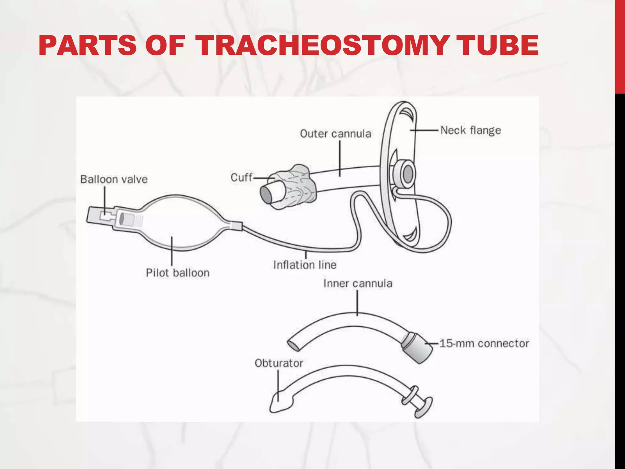 Tracheostomy | PPT