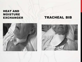 High Humidity Trach Collar